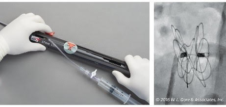 CARDIOFORM ASD Occluder | Gore Medical