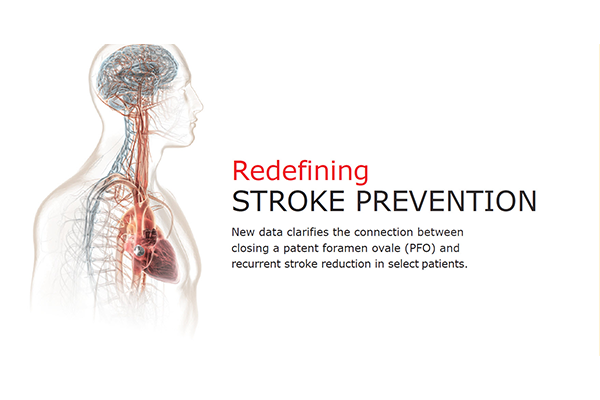 Resources | GORE® CARDIOFORM Septal Occluder for PFO Closure | Gore Medical