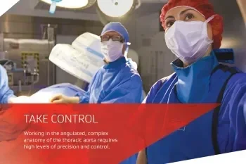 The device behind the data: GORE® TAG® Conformable Thoracic Stent Graft ...